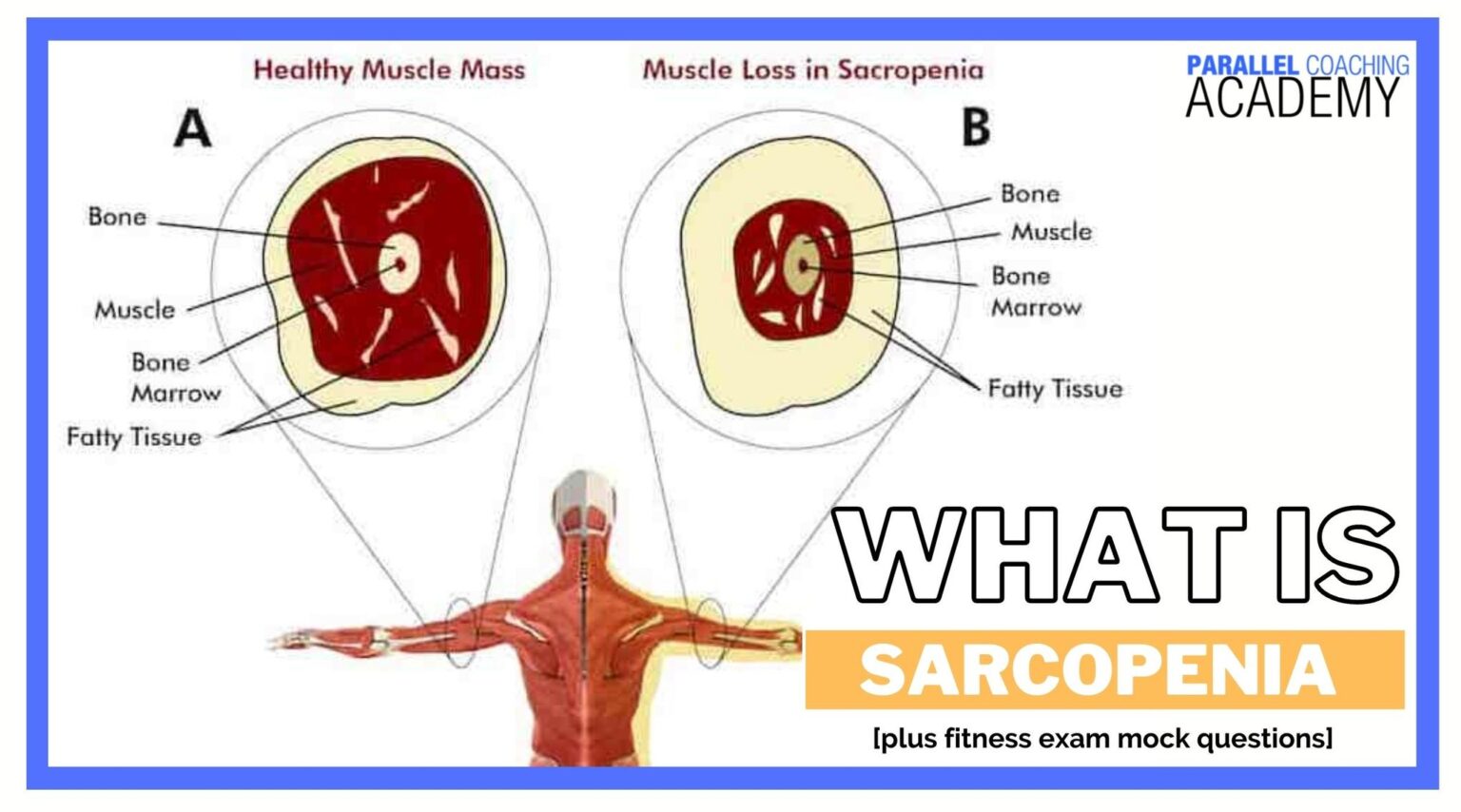 What is Sarcopenia? (muscle loss with aging)